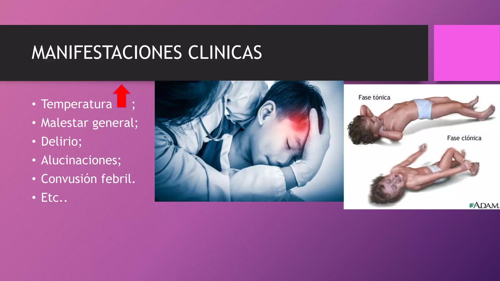 1 fiebre y convulsiones febriles | PPT