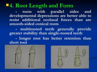1. fixed partial denture finals1 | PPT
