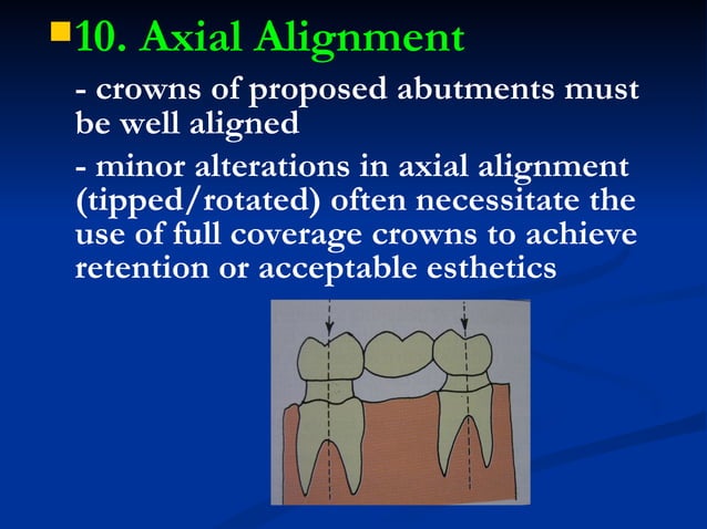 1. fixed partial denture finals1 | PPT | Dental Health | Diseases and ...