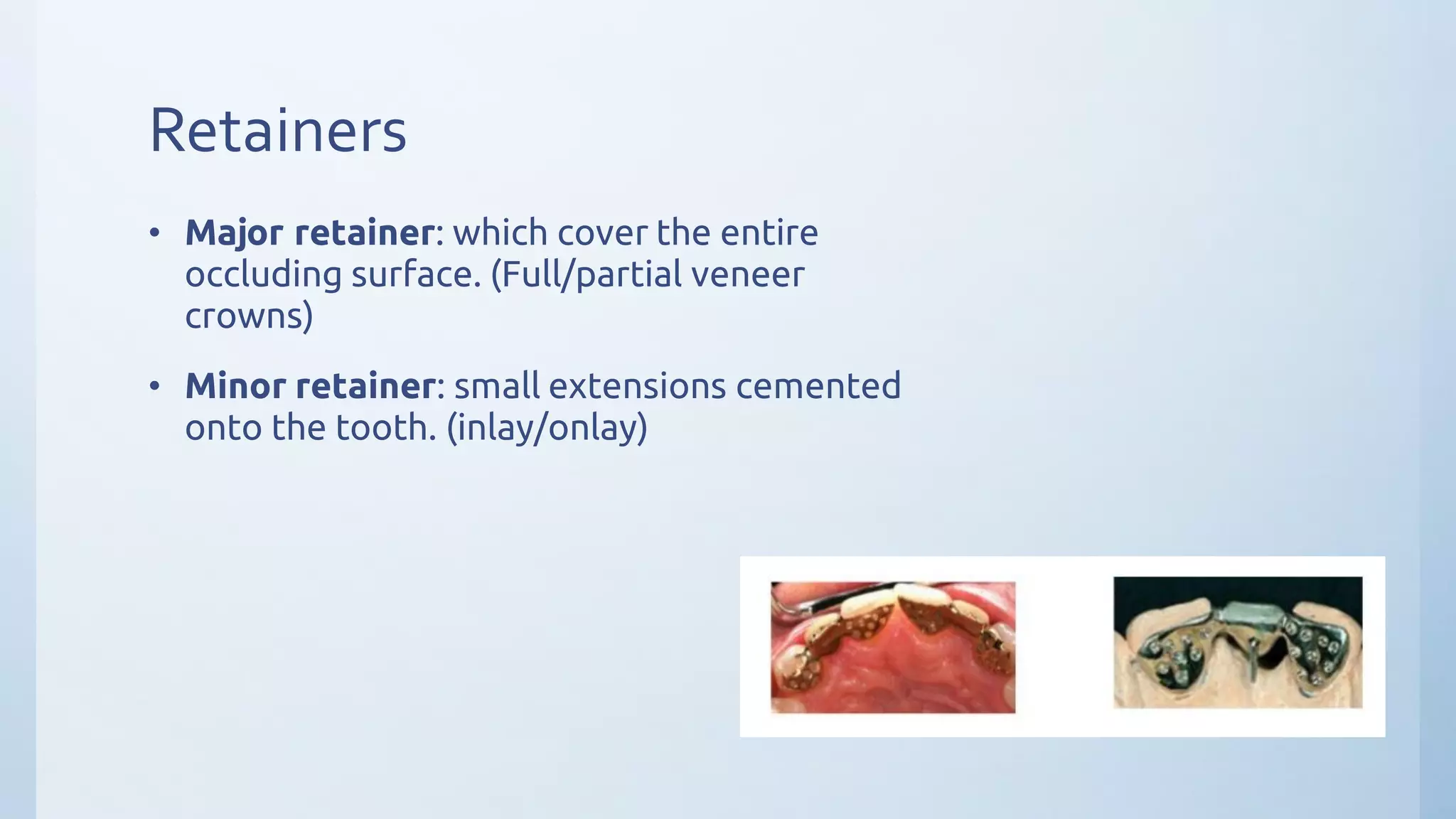 1/2 Fixed Partial Dentures (FPD) Introduction & Basics @ Faryal | PDF