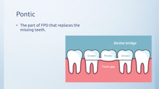 1/2 Fixed Partial Dentures (FPD) Introduction & Basics @ Faryal | PDF