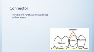 1/2 Fixed Partial Dentures (FPD) Introduction & Basics @ Faryal | PDF