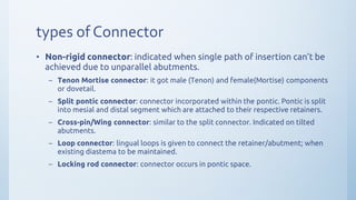 1/2 Fixed Partial Dentures (FPD) Introduction & Basics @ Faryal | PDF