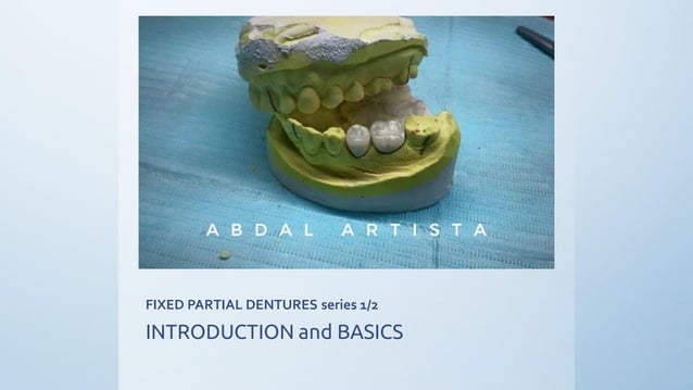 1/2 Fixed Partial Dentures (FPD) Introduction & Basics @ Faryal | PDF