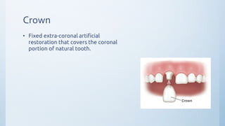 1/2 Fixed Partial Dentures (FPD) Introduction & Basics @ Faryal | PDF