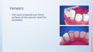 1/2 Fixed Partial Dentures (FPD) Introduction & Basics @ Faryal | PDF
