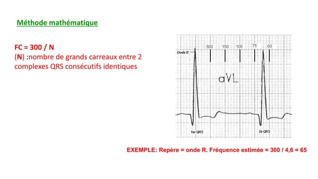1- Formation ECG TOUBIB World- ECG normal.pptx