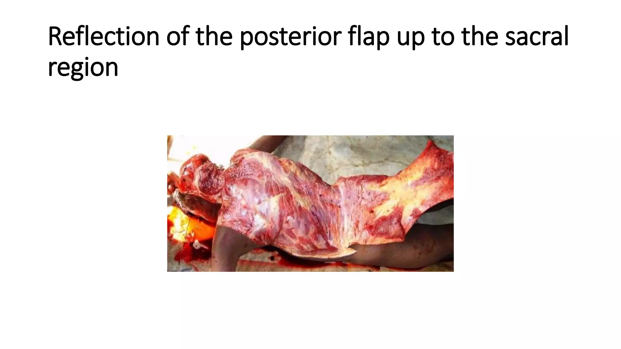 1-fourth incision dr shahid autopsy.pptx