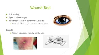 Geiger- Interdisplinary approach to wound management | PPTX