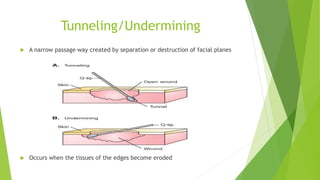 Geiger- Interdisplinary approach to wound management | PPT