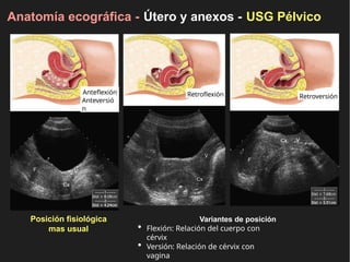 1 - Ginecología - Útero y anexos.pptx