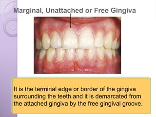 1-Gingiva.pptx.periodontium gingiva .macro and microscopic features | PPTX
