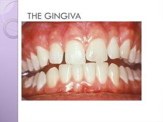 1-Gingiva.pptx.periodontium gingiva .macro and microscopic features | PPTX