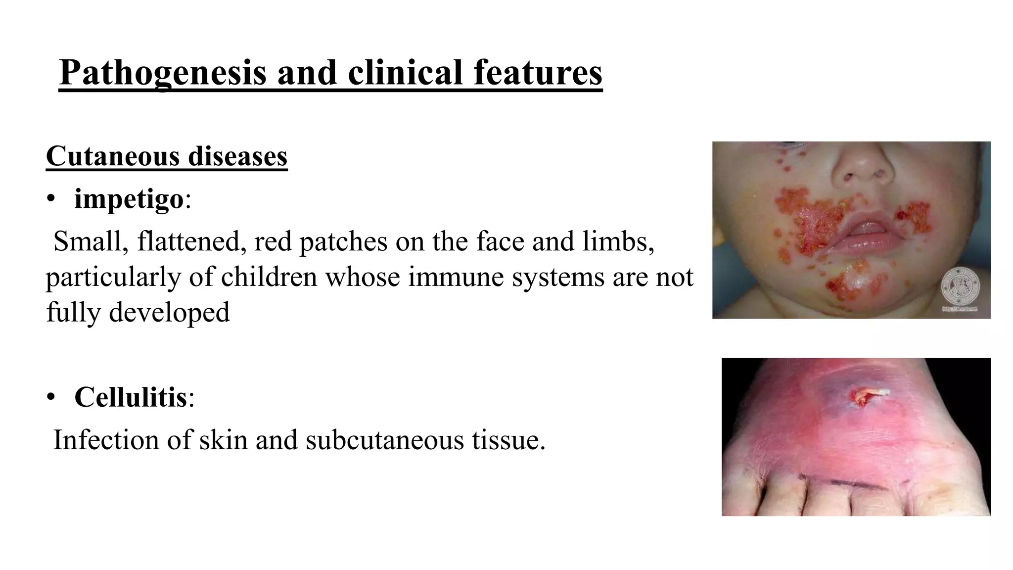 Gram Positive Cocci-Staphylococcus | PPTX