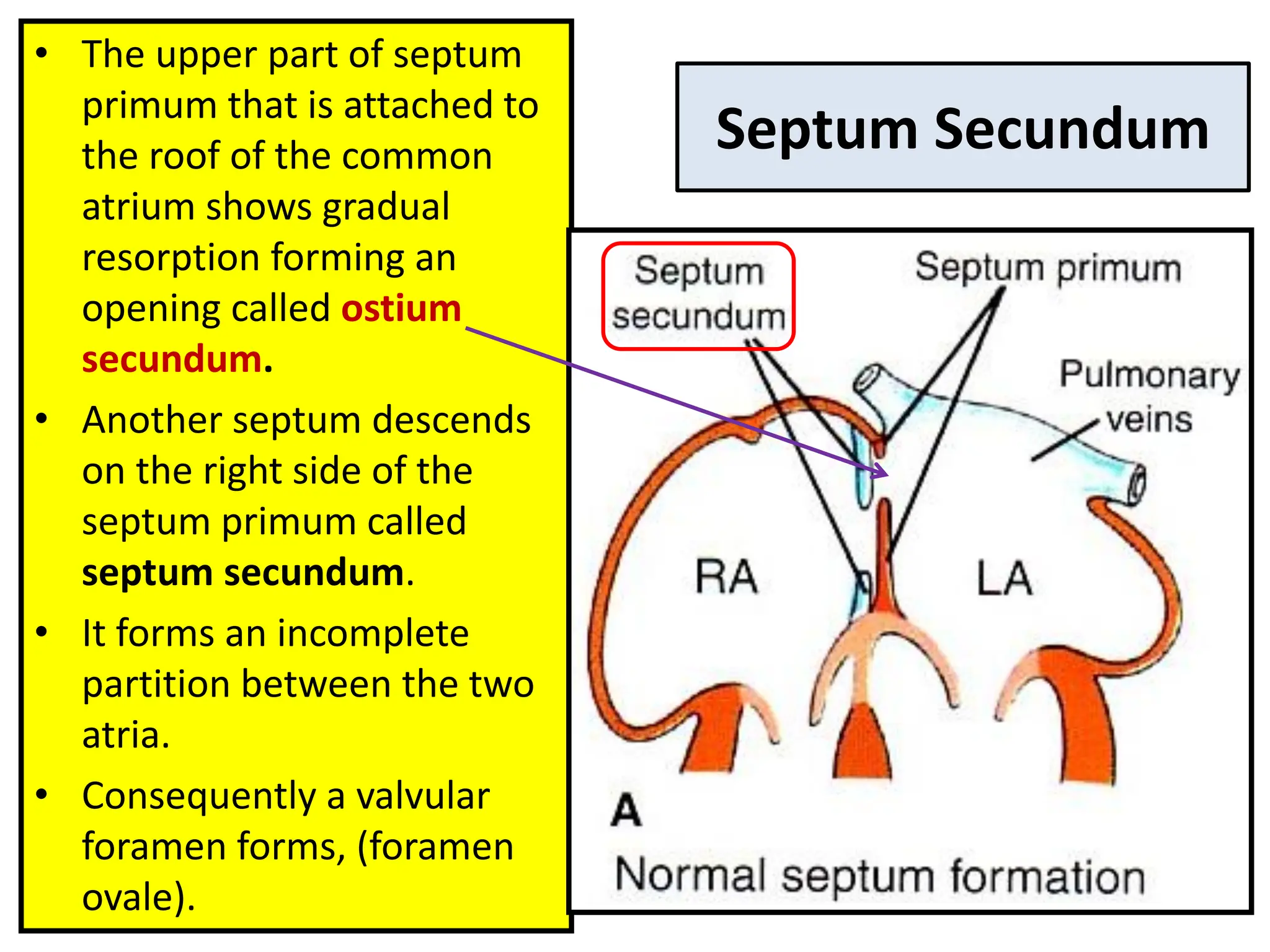 Embryology of heart and understand basic heart disease | PPT
