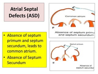 Embryology of heart and understand basic heart disease | PPT