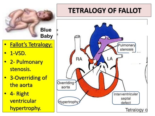 Embryology of heart and understand basic heart disease | PPT