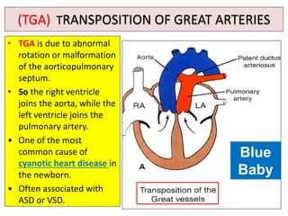 Embryology of heart and understand basic heart disease | PPT