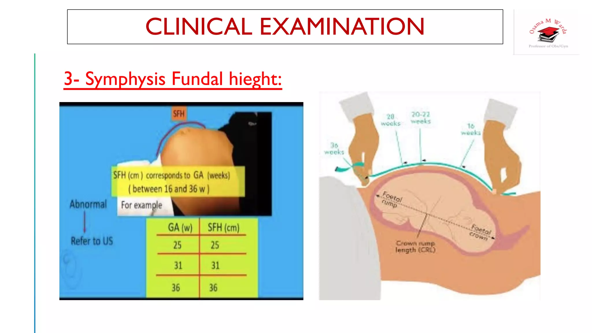 ESTIMATION OF GESTATIONAL AGE | PDF
