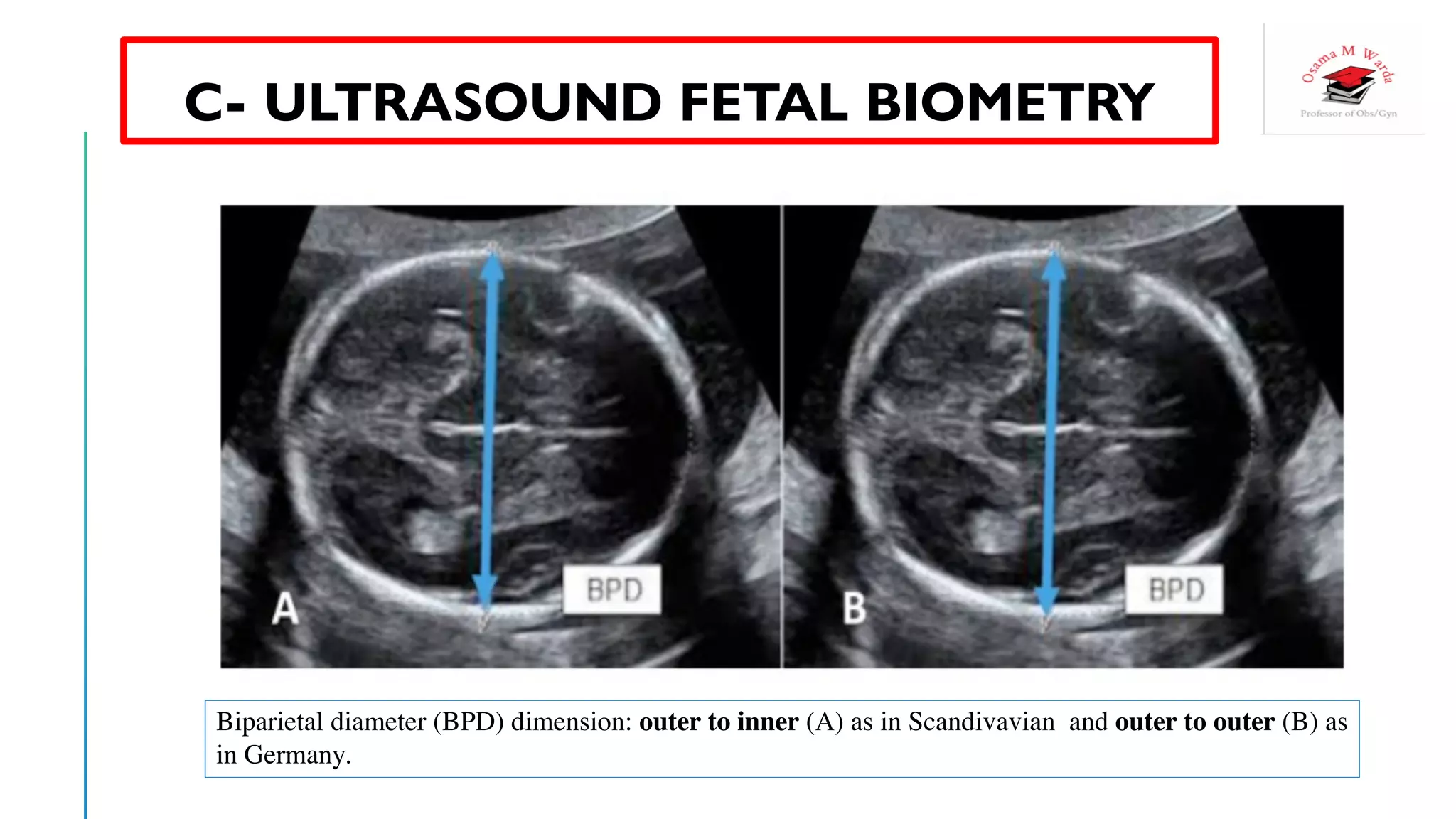 ESTIMATION OF GESTATIONAL AGE | PDF