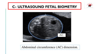 ESTIMATION OF GESTATIONAL AGE | PDF