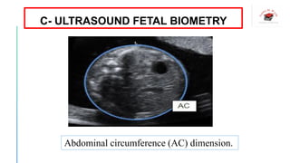 HOW TO CALCULATE GESTATIONAL AGE | PDF