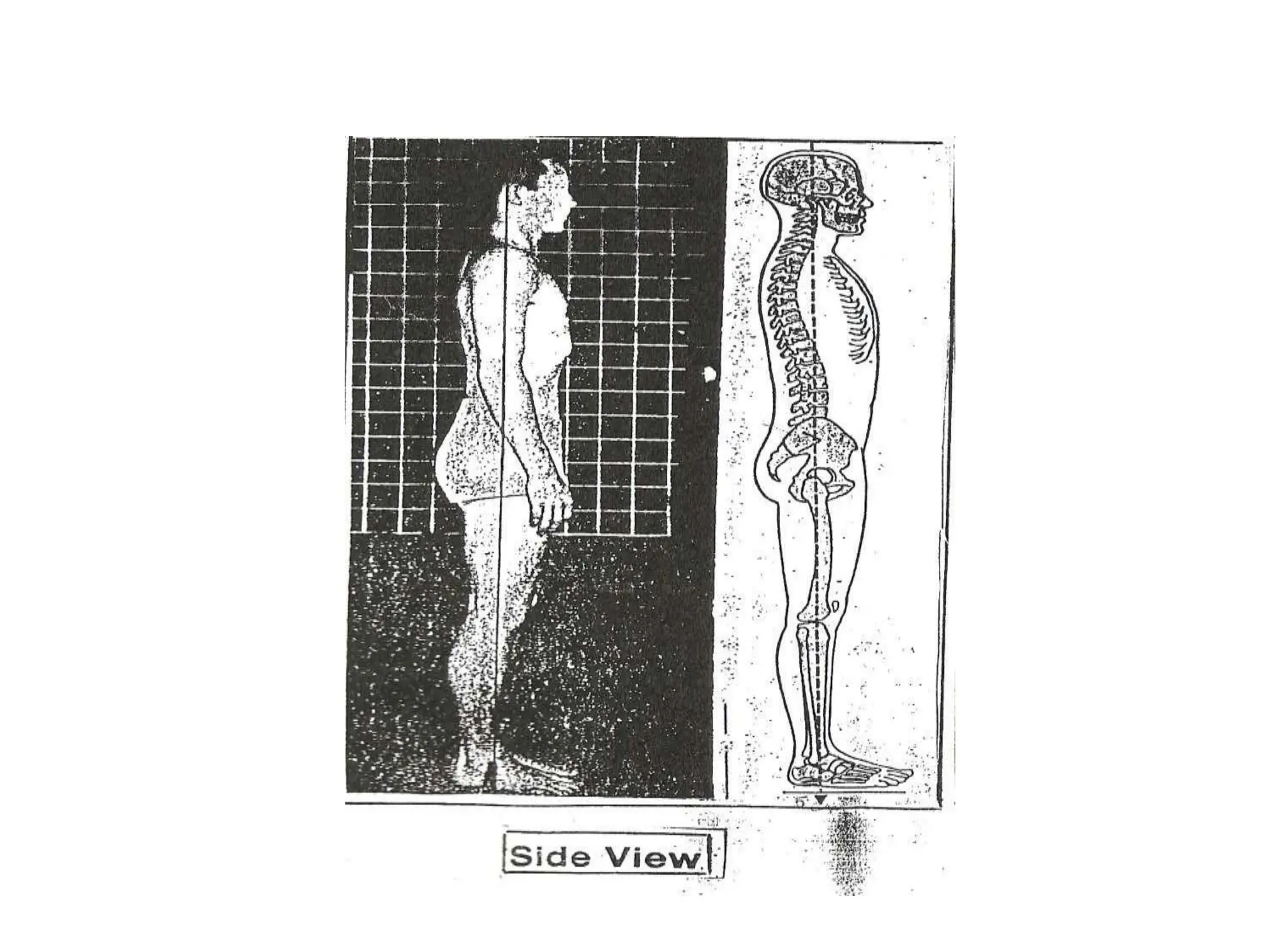 HUMAN POSTURE and it is help full for physiotherapy and neursing ...