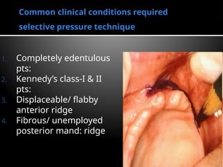 1-Impression Techniques, Theories & Objectives.pptx