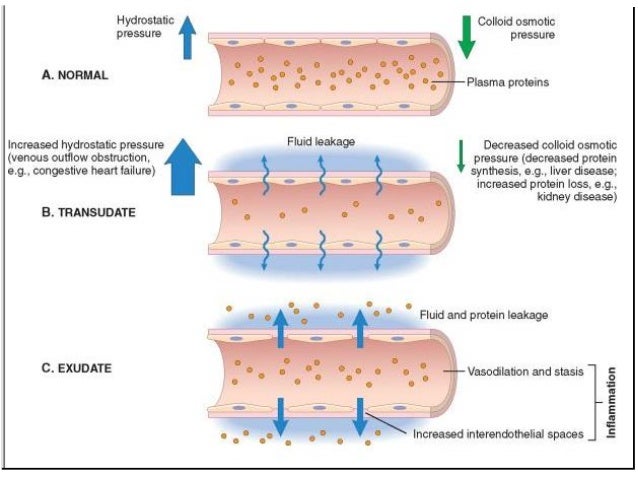 1. inflammation with vascular events dr ashutosh kumar
