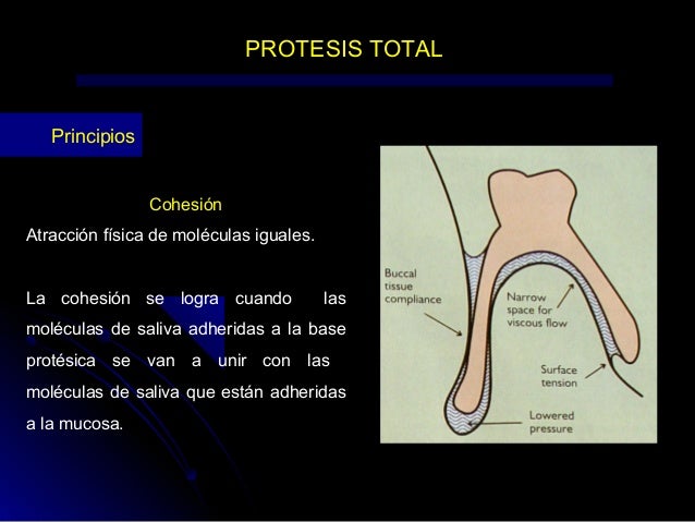 Generalidades de Protesis Total