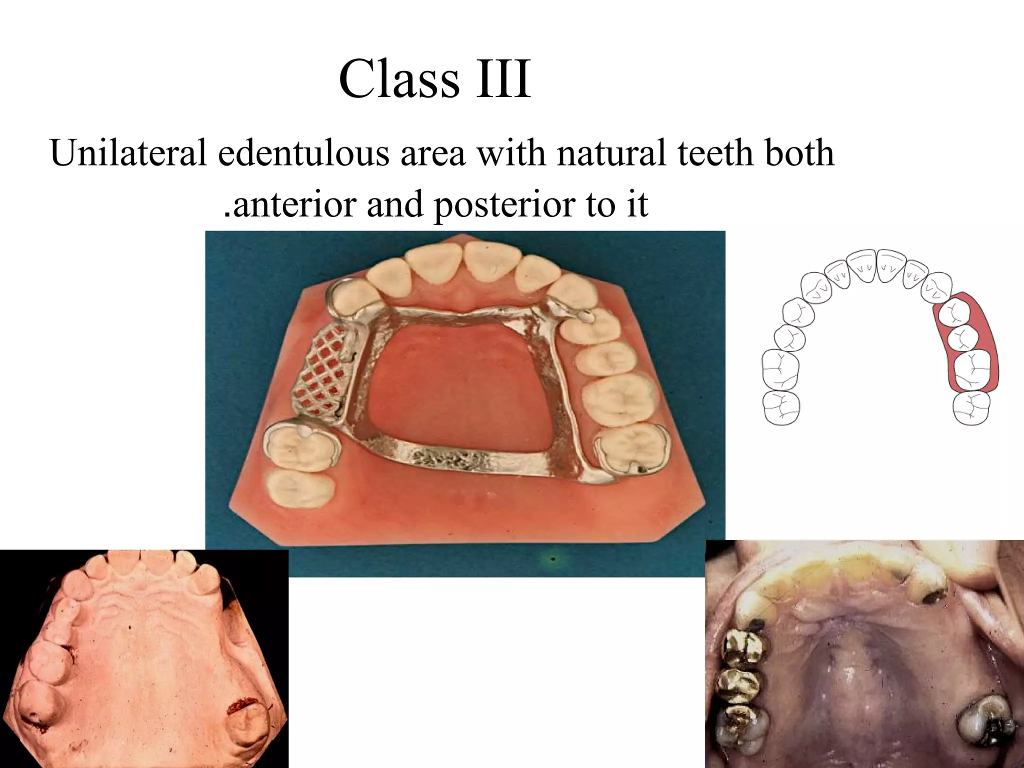 1 introduction-and-classification | PPT