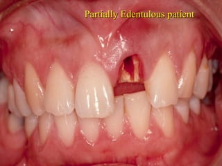 1 introduction-and-classification | PPT