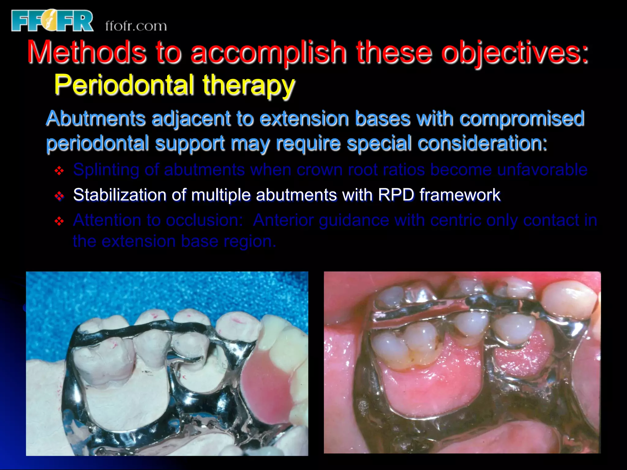 1.introduction and basic components of rpd's copy | PDF | Dental Health ...