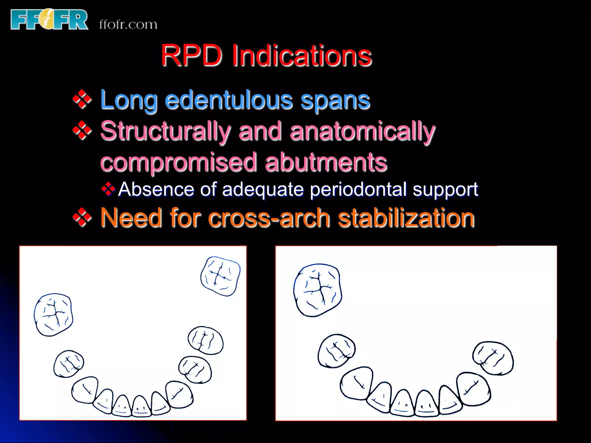1.introduction and basic components of rpd's copy | PDF | Dental Health ...