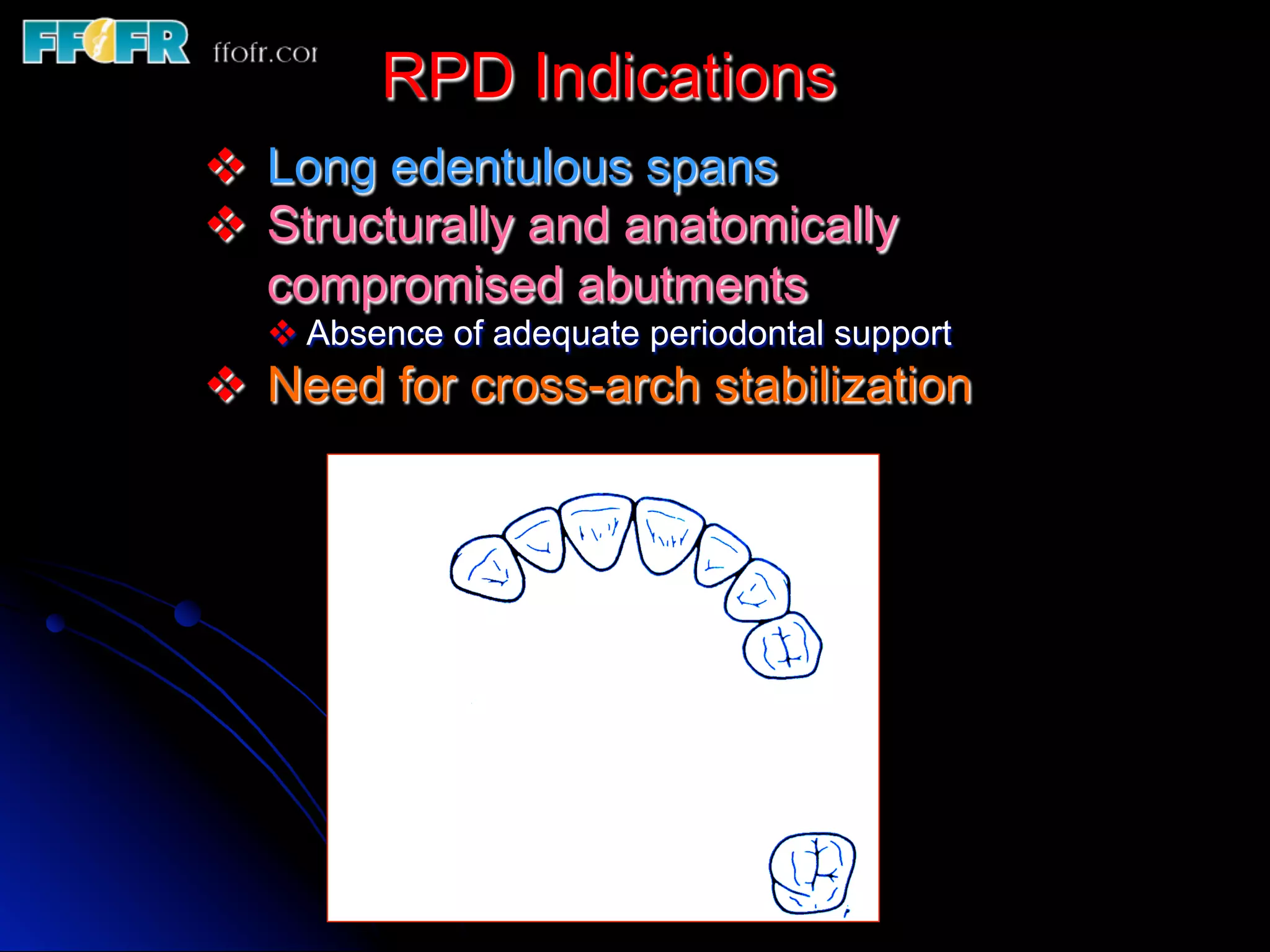 1.introduction and basic components of rpd's copy | PDF | Dental Health ...