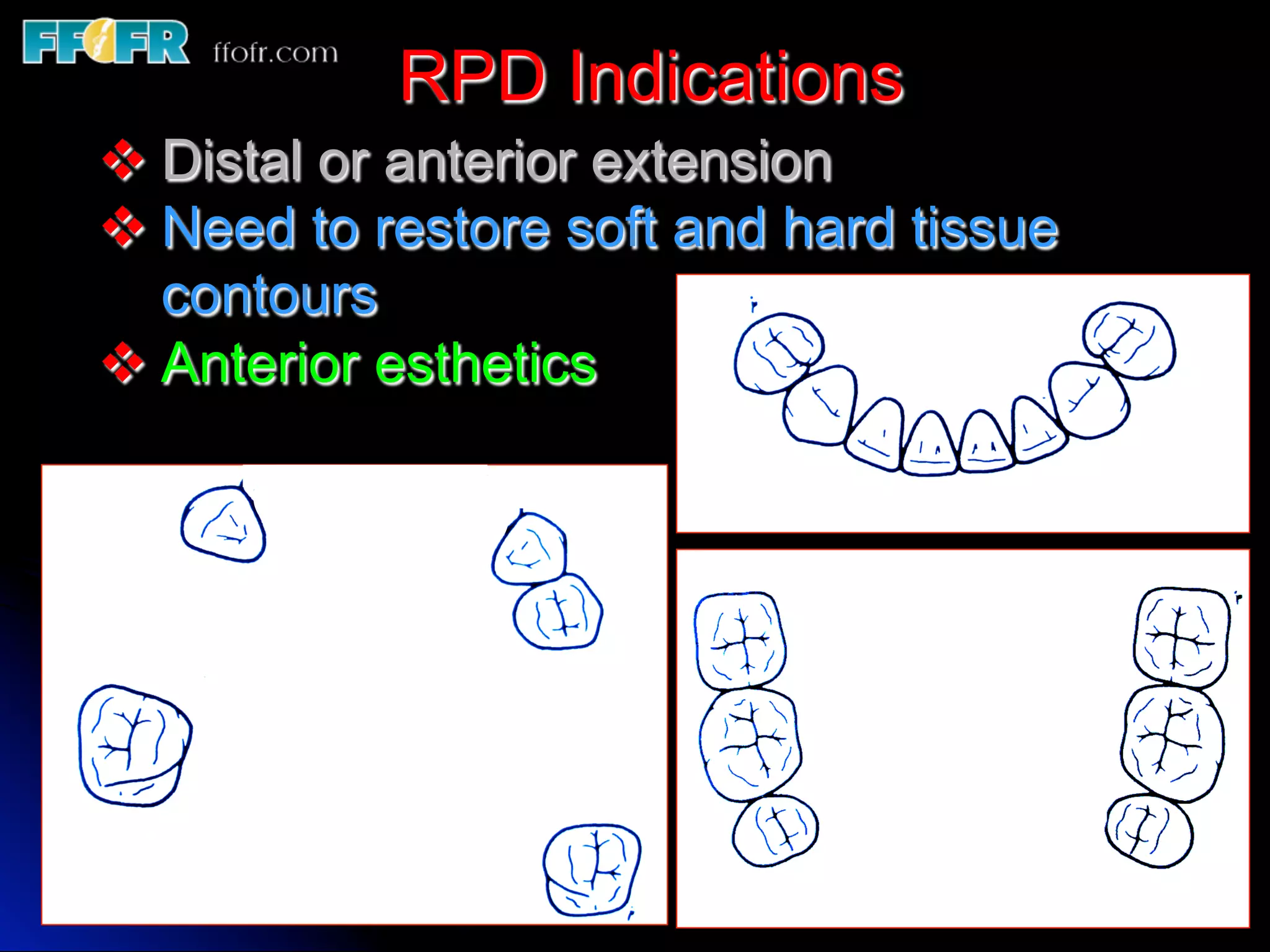 1.introduction and basic components of rpd's copy | PPT