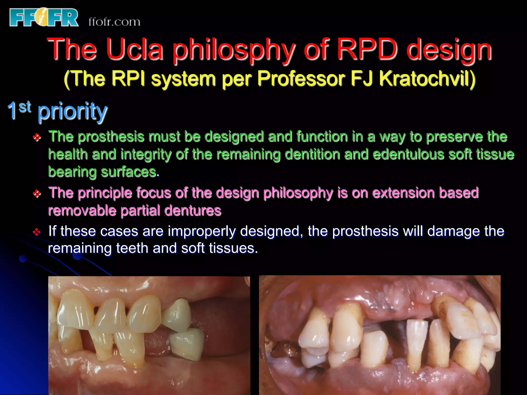 1.introduction and basic components of rpd's copy | PDF | Dental Health ...