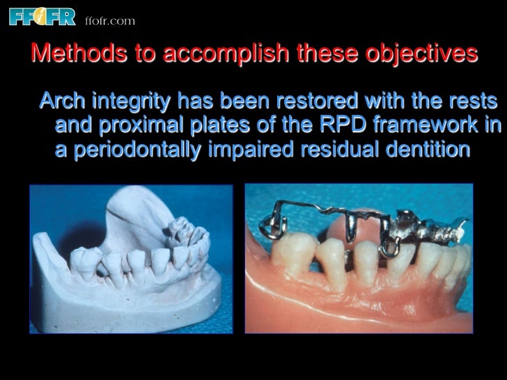 1.introduction and basic components of rpd's copy
