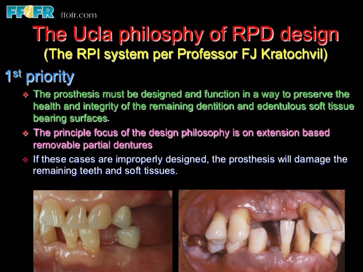 1.introduction and basic components of rpd's copy