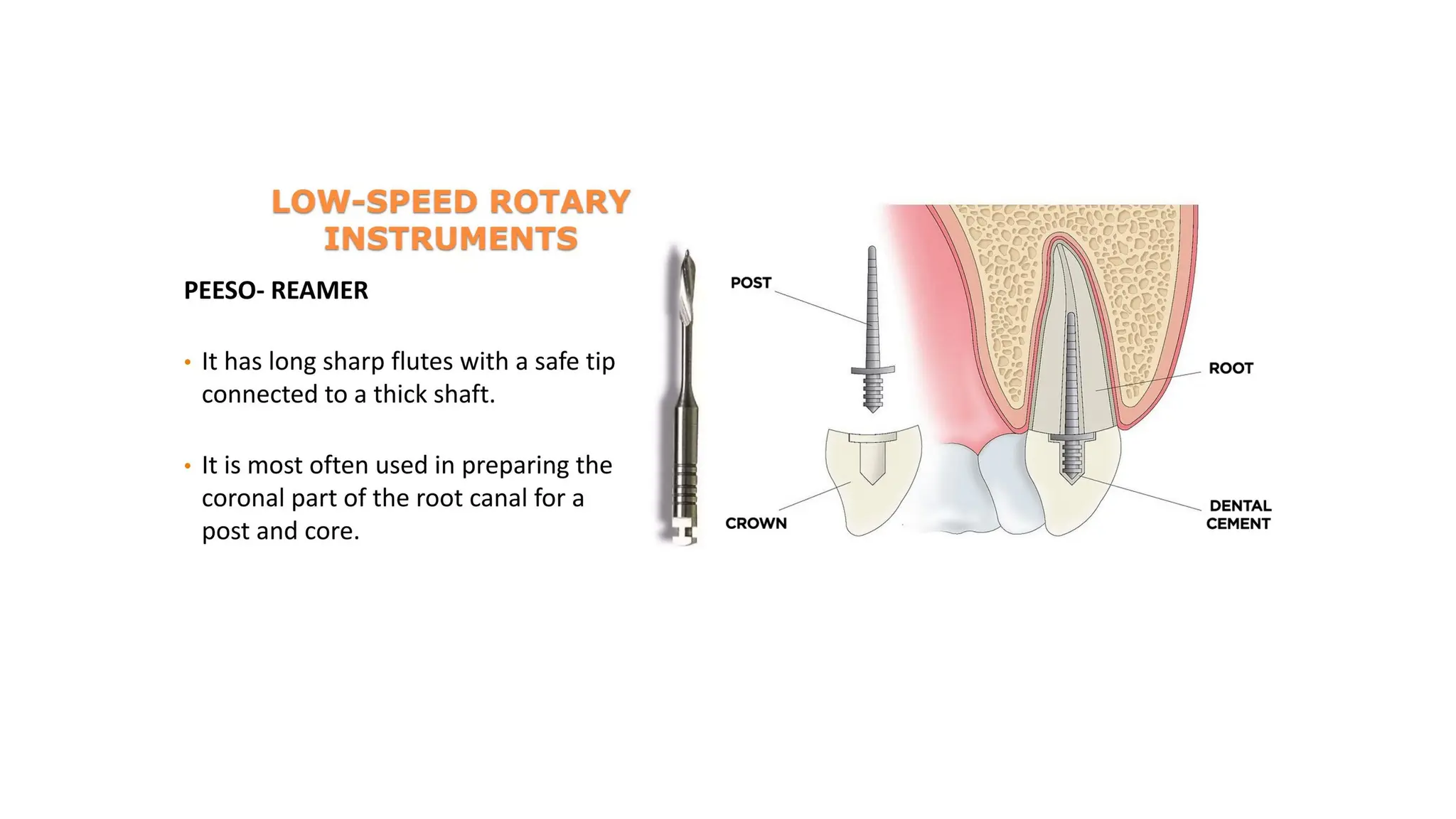 1- introduction to endodontics and instruments.pptx