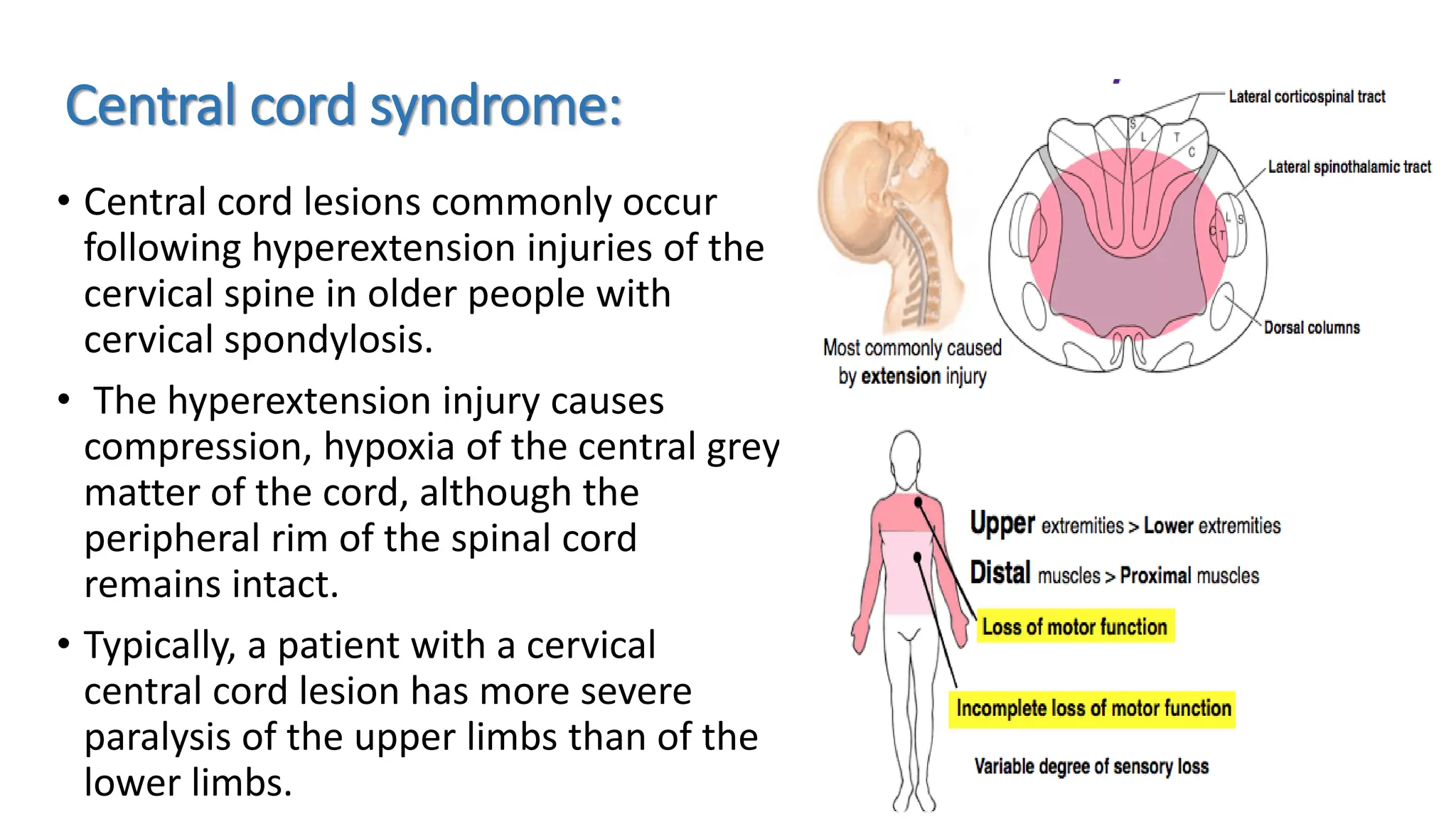 1-Introduction to SCI.pdf explain of types of injury | PDF