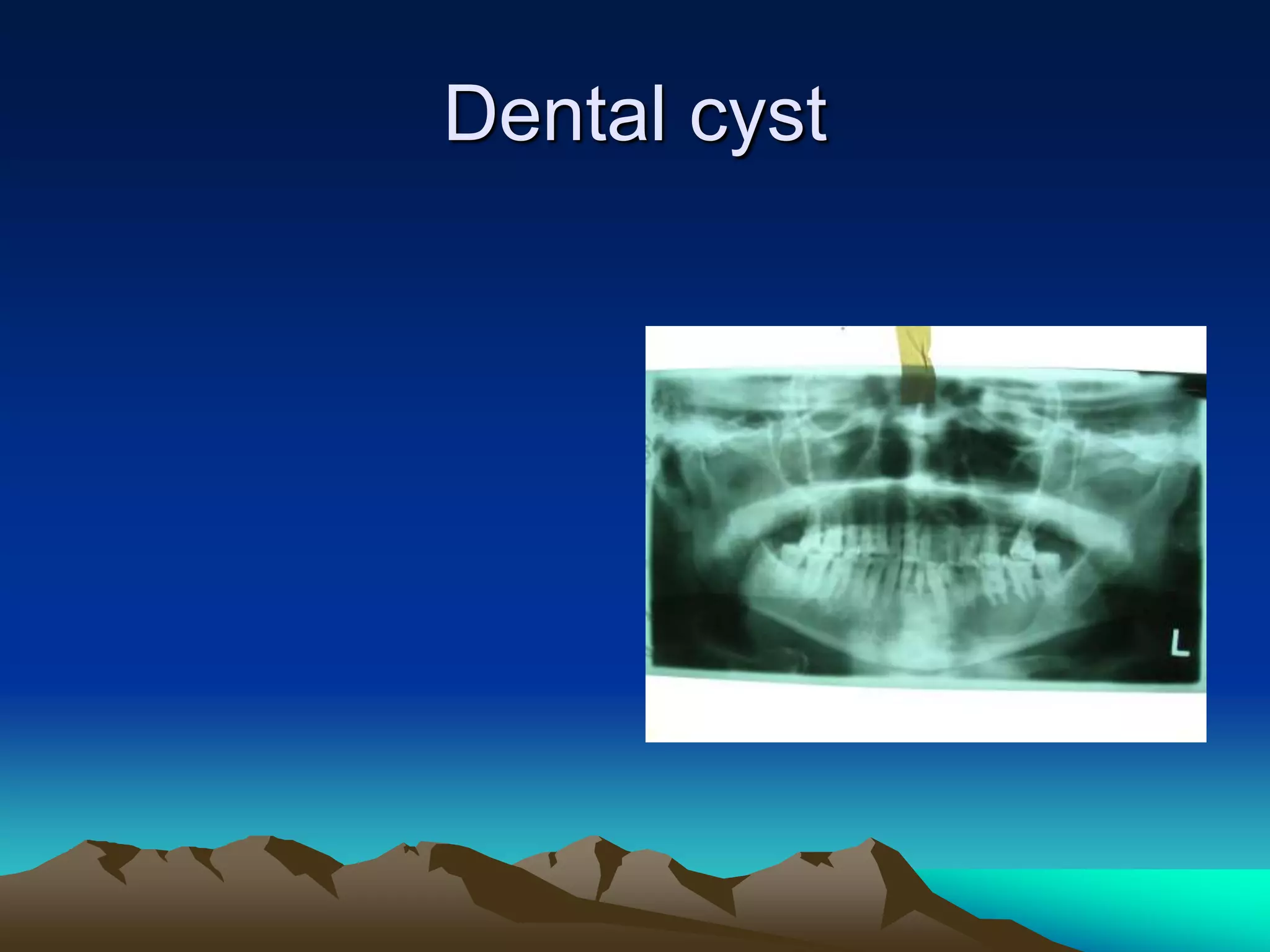1 intro to cyst, classification & pathophysiology | PPT