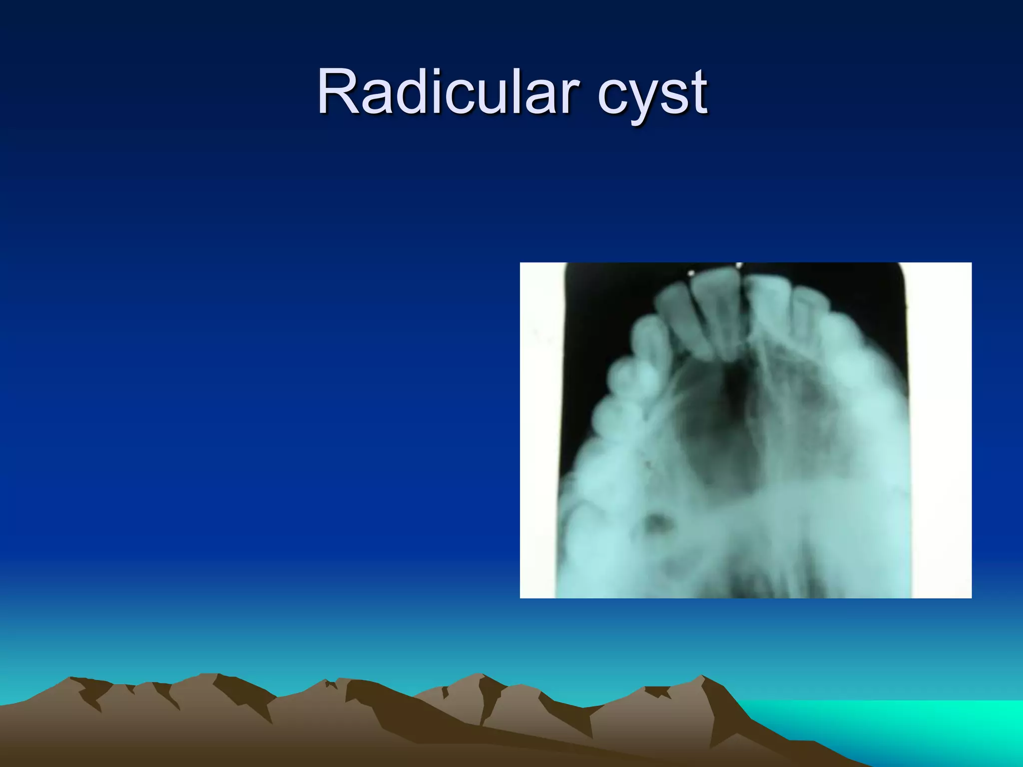 1 intro to cyst, classification & pathophysiology | PPT