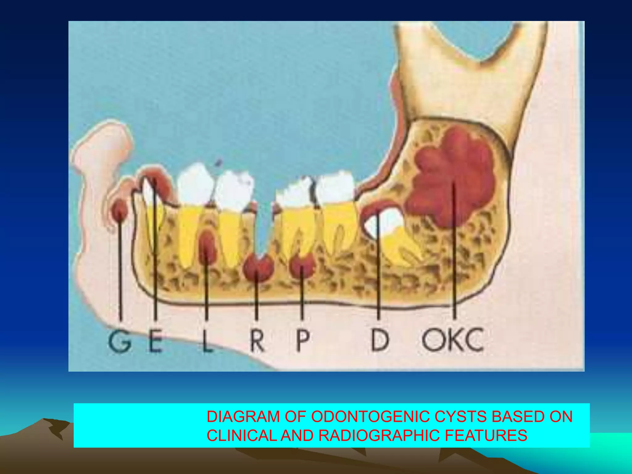 1 intro to cyst, classification & pathophysiology | PPT