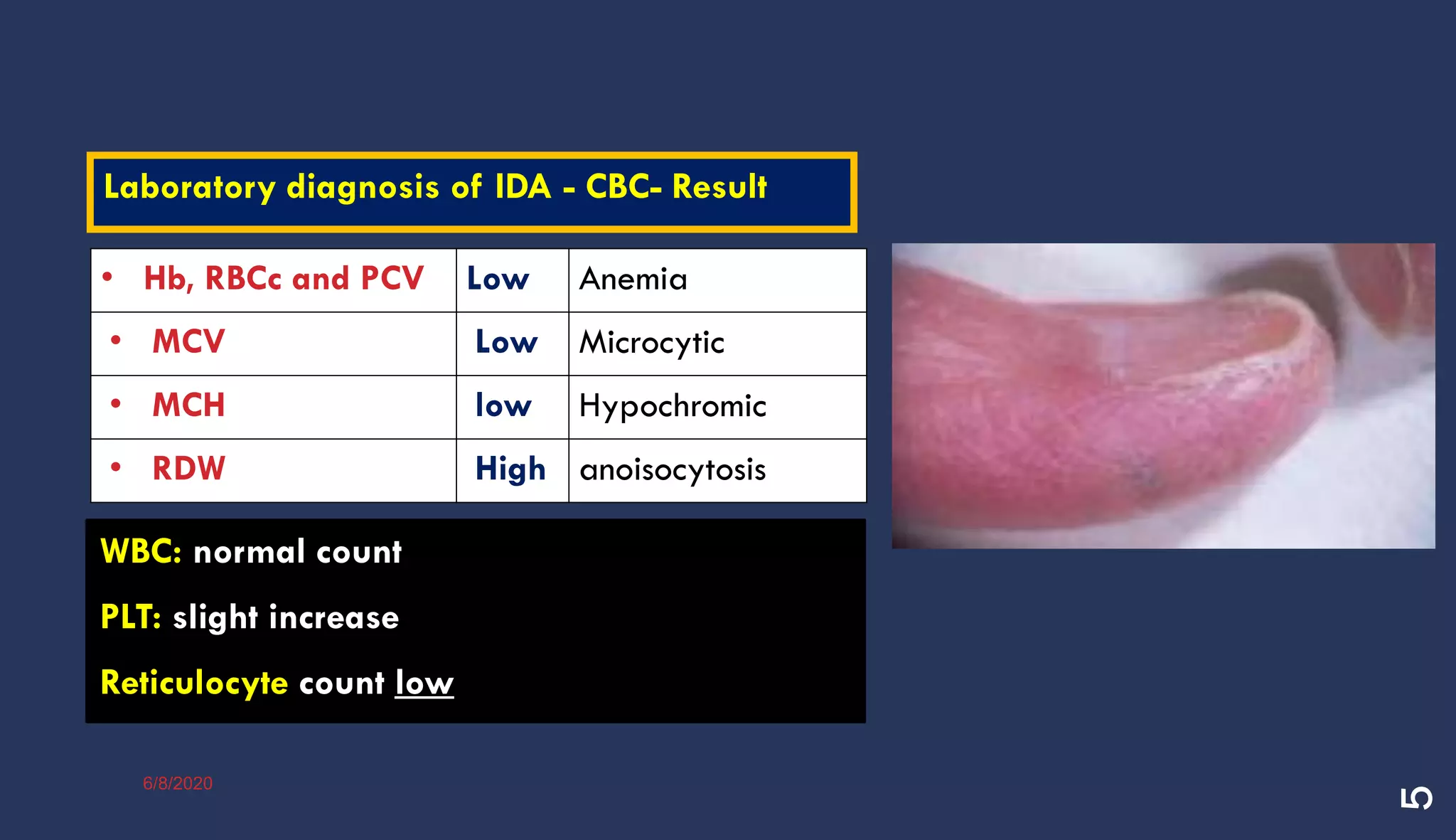1 iron deficiency anemia (ida) | PDF