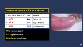 1 iron deficiency anemia (ida) | PDF