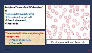 1 iron deficiency anemia (ida) | PDF