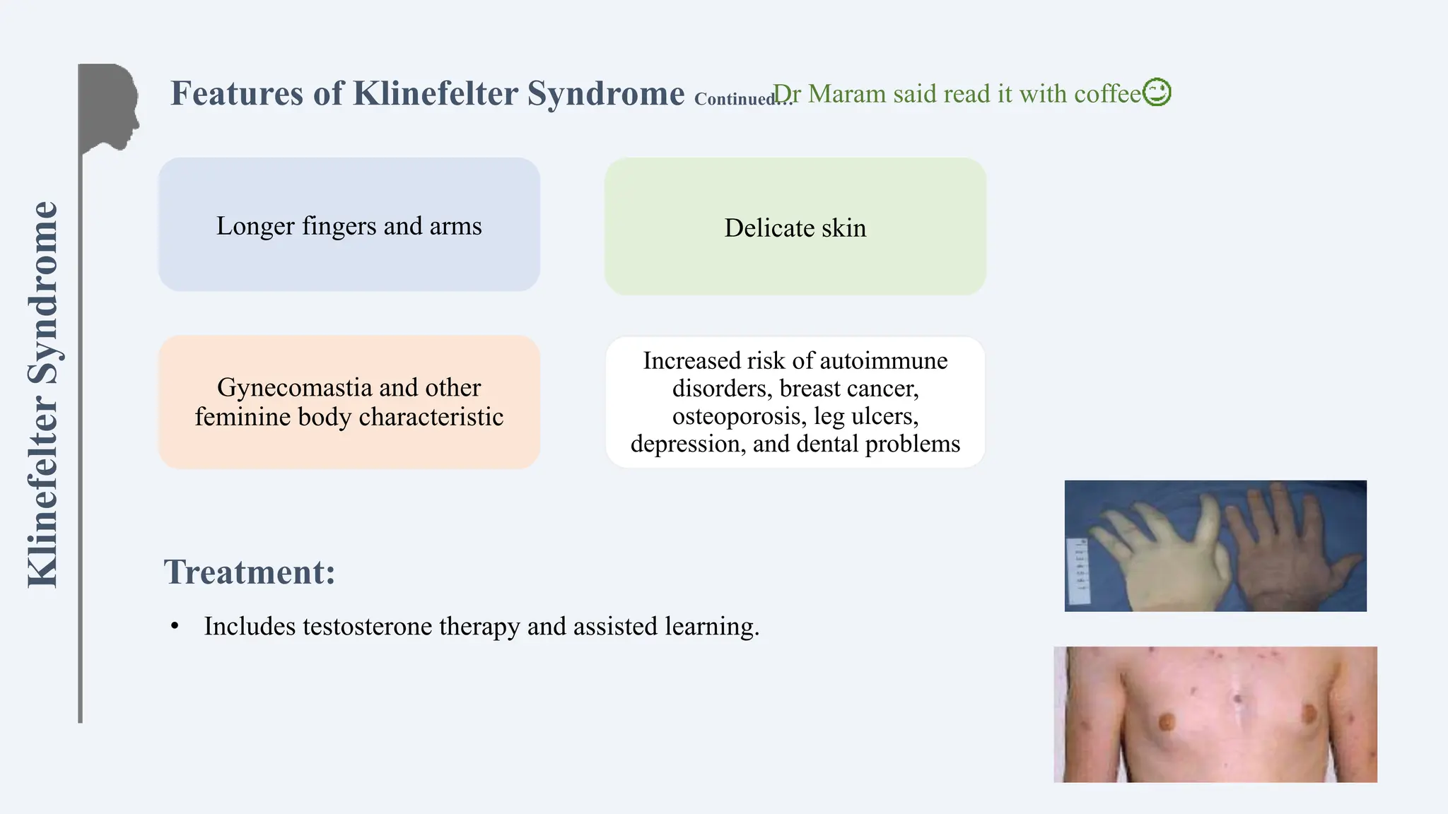 1-Klinefelter, Turner and Down Syndromes.pptx
