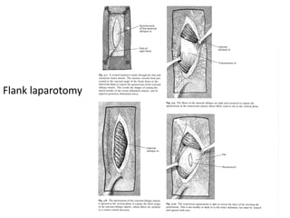 1- Laparotomy.pdf