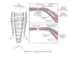 1- Laparotomy.pdf